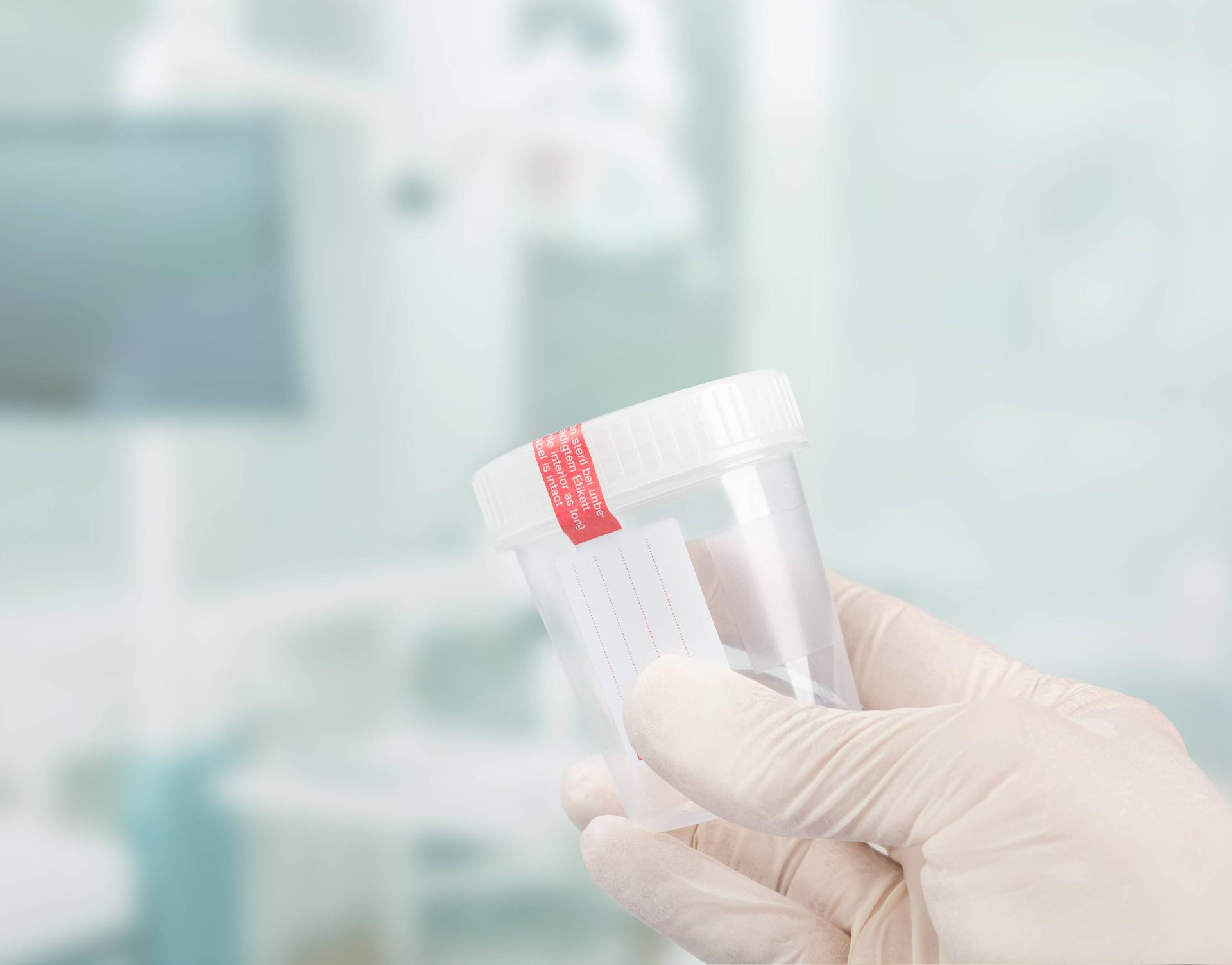 ΕΞΕΤΑΣΗ ΣΠΕΡΜΑΤΟΣ (ΣΠΕΡΜΟΔΙΑΓΡΑΜΜΑ) | Alpha Prolipsis