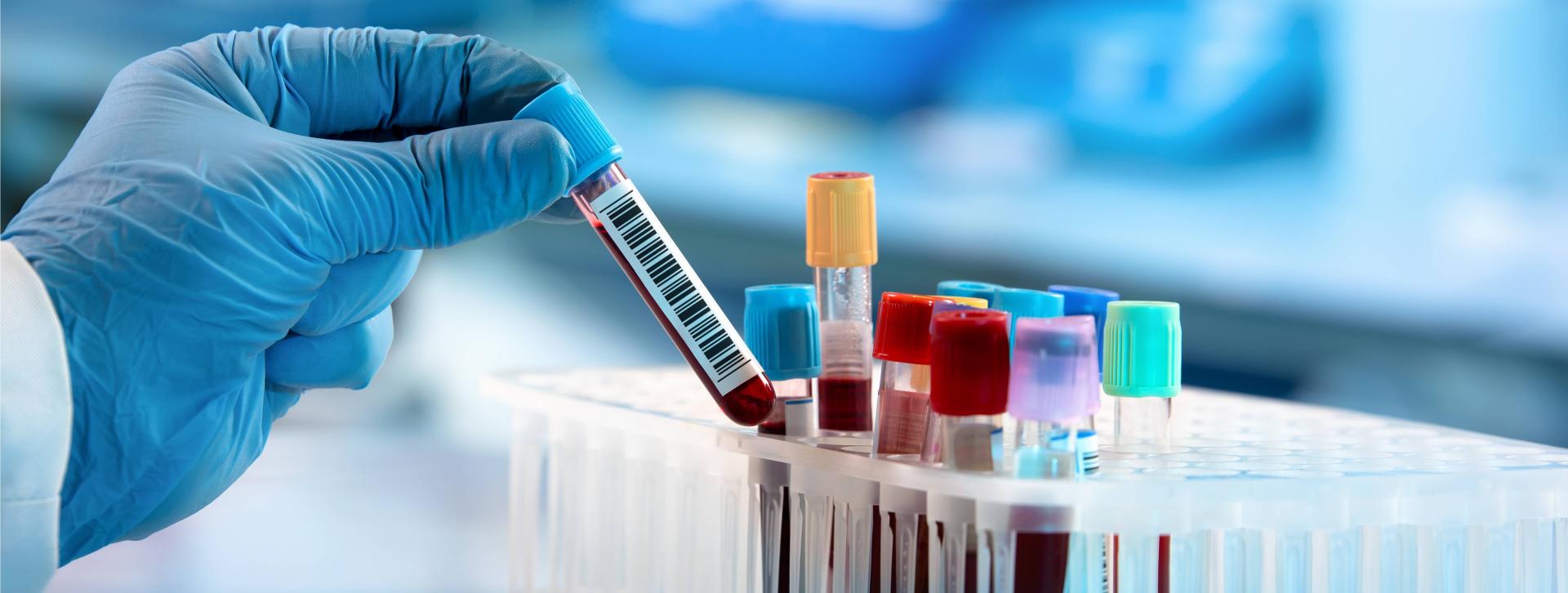ΑΙΜΑΤΟΛΟΓΙΚΕΣ ΕΞΕΤΑΣΕΙΣ | Alpha Prolipsis